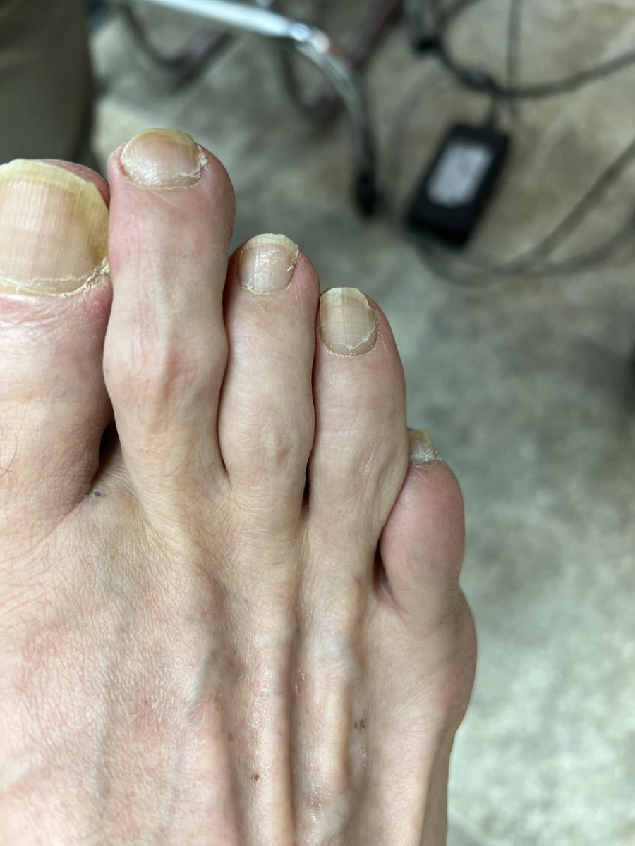 Quick fix, for long relief - Podiatry Associates