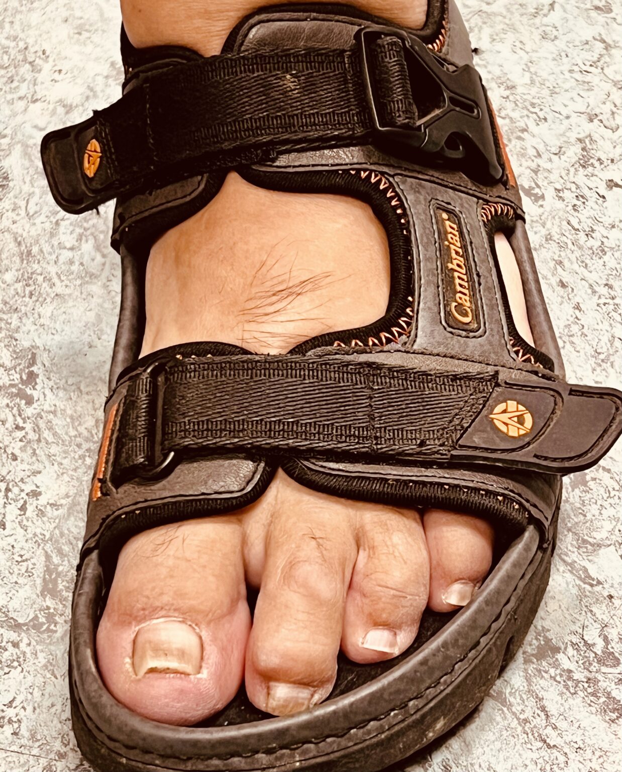 Finally an Orthotic friendly sandal for men - Podiatry Associates